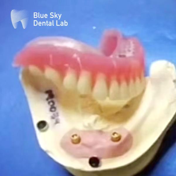Quality Titanium Dental Locator With Removable Denture And Ball Cap Attachments for sale