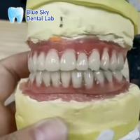 Quality Full Upper And Lower Titanium Bar Blue Sky Dental Implants for sale