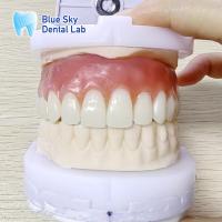 China Custom Full Upper Acrylic Denture Natural Acrylic Removable Partial Denture for sale