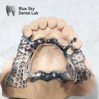 China Blue Sky Dental Framework Partial Maxillary Denture Cast Metal Framework for sale