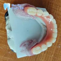 China Missing Teeth Acrylic full Denture Restoration Acrylic Complete Denture for sale