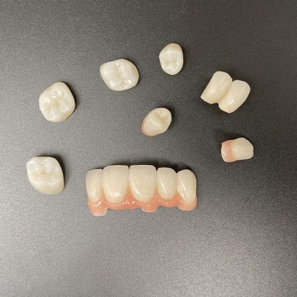 Quality Layered Zirconia Crowns Pink Porcelain Zirconia Dental Crown For Aesthetic for sale