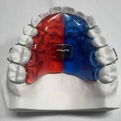 China Stainless Steel Acrylic Screw Expander Orthodontic Treatment Removable for sale