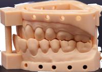 China Dental 3D Printer Resin High Precision 90 Shore D Hardness Odorless Smooth Surface for sale