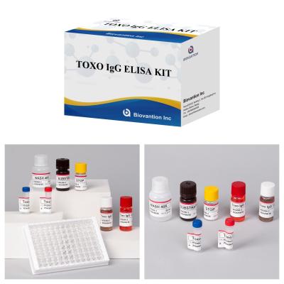 중국 TOXO Ig G 질병 모니터링을 위한 민감하고 특수한 Elisa 테스트 키트 판매용