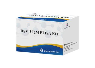 중국 HSV 2 IgM 토치 ELISA 테스트 키트 사용 지침 판매용