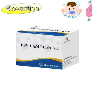 China Torch ELISA Test Kit HSV 1 IgM High Hot Sale Diagnostic Reagent IVD for sale