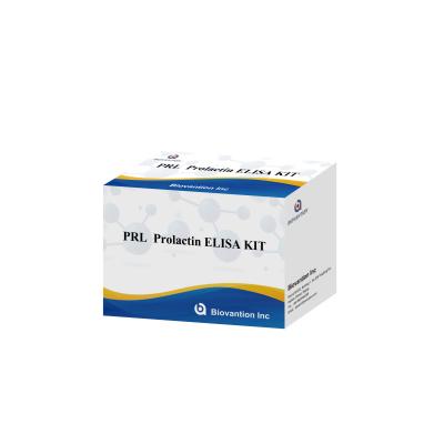 China PRL Quantitative Human Hormones Diagnostic Detect Reagent Kit for sale