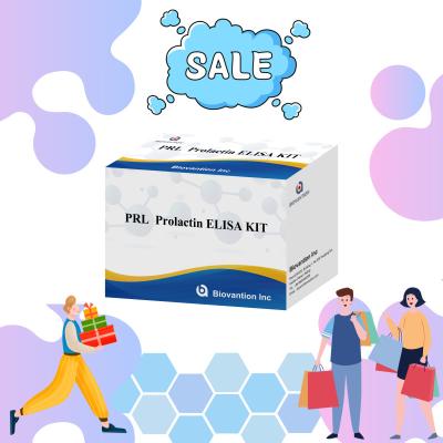 Cina PRL Hormoni umani quantitativi Kit di reagenti diagnostici per il rilevamento in vendita