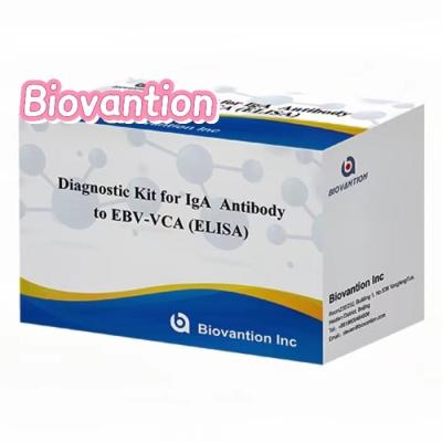 중국 50μl 혈청 표본을 이용한 의료 진단용 고 민감성 EBV VCA IgA ELISA 키트 판매용