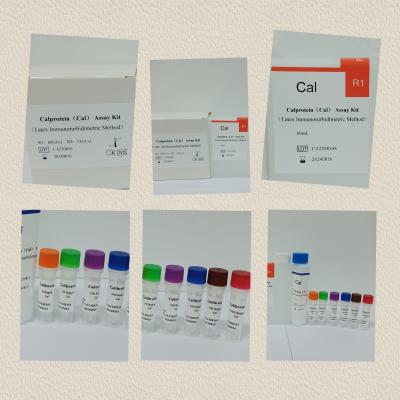 Cina Kit di analisi della cal proteina Kit di reagenti di rilevamento quantitativo per la diagnosi umana in vendita