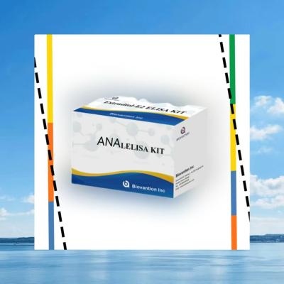 China Anti ANA IgG ELISA Test Kit  Anti Nuclear IgG Antibody Qualitative Detection for sale