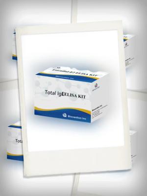 중국 전체 IgE 항체 ELISA 테스트 키트 혈청 / 플라즈마 판매용
