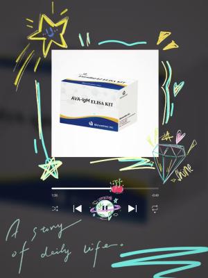 중국 안티 ACA IgM ELISA 테스트 키트 항혈관 리핀 질적 판매용