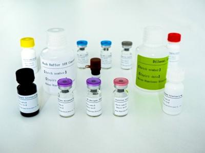 중국 정확성 및 민감성 ELISA 테스트 키트 신속하고 쉬운 검출 TB IGRA ELISA 진단 판매용