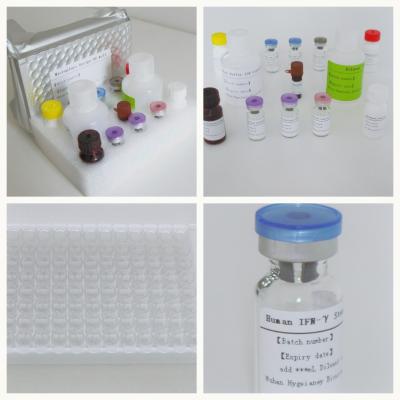 중국 정확성 및 민감성 ELISA 테스트 키트 신속하고 쉬운 검출 TB IGRA ELISA 진단 판매용