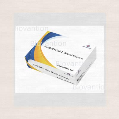 중국 감수성 HIV 1/2 검출 읽기 시간 5분 25 테스트 판매용