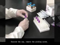 Anticorpos sensibles a la tiroides peroxidasa Kit de prueba Elisa para el diagnóstico humano