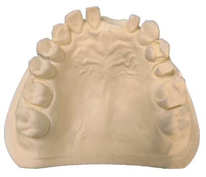 Quality AI-3 High Performance Dental Scanner for sale