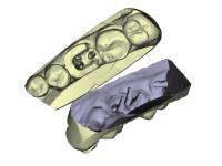 China AI-3 High Performance Dental Scanner for sale