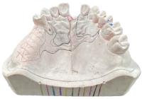 China AI-3 High Performance Dental Scanner for sale