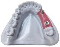 China AI-3 High Performance Dental Scanner for sale