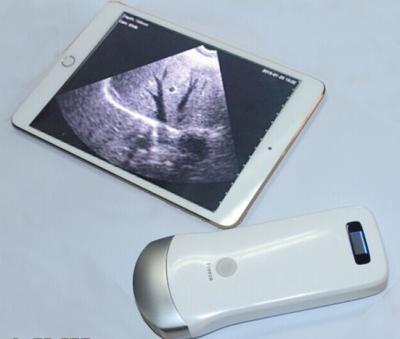 China WIRELESS ULTRASOUND SCANNER UP-Q2C 3.5MHz Convex probe for sale