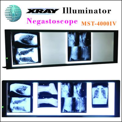 China Upgrade LED X-ray Negatoscope Mst-4000IV Four Panels with 7 Level LED Display Brightness Control for sale