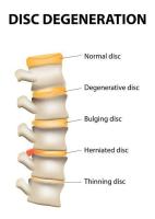 China Non Surgery Cervical Decompression Machine High Negative Pressure for sale