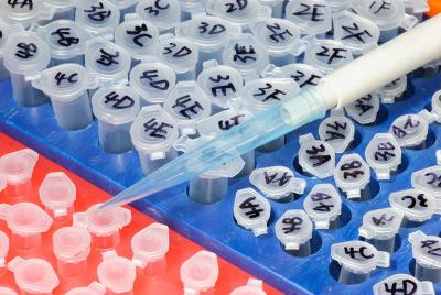 China EO Steriele 1,5 ml Polypropyleen gegradueerde microcentrifugebuizen met snap cap Duurzame microcentrifuge laboratoriumbuizen Te koop