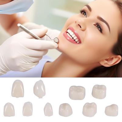 Cina SJ Temporary Dental Crown Veneers for Anterior Front and Molar Posterior Teeth OEM Wholesale in vendita