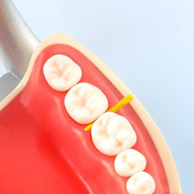 Cina SJ Dental instruments consumables disposable colorful fixing orthodontic dental wooden wedges in vendita