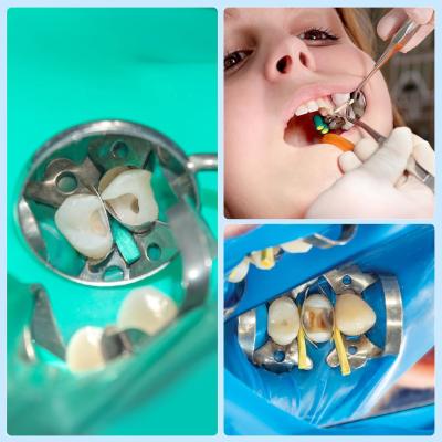 Cina SJ Dental instruments consumables disposable colorful fixing orthodontic dental wooden wedges in vendita