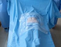 China Caesarian Surgical Drape for sale