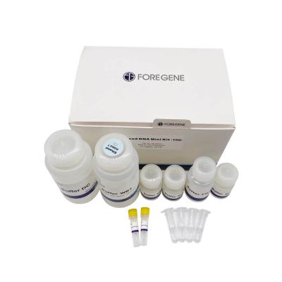 Κίνα Αίματος Genomic DNA μίνι εξαρτήσεων DNA απομόνωσης αντιδραστήρια δοκιμής εξαρτήσεων κλινικά προς πώληση